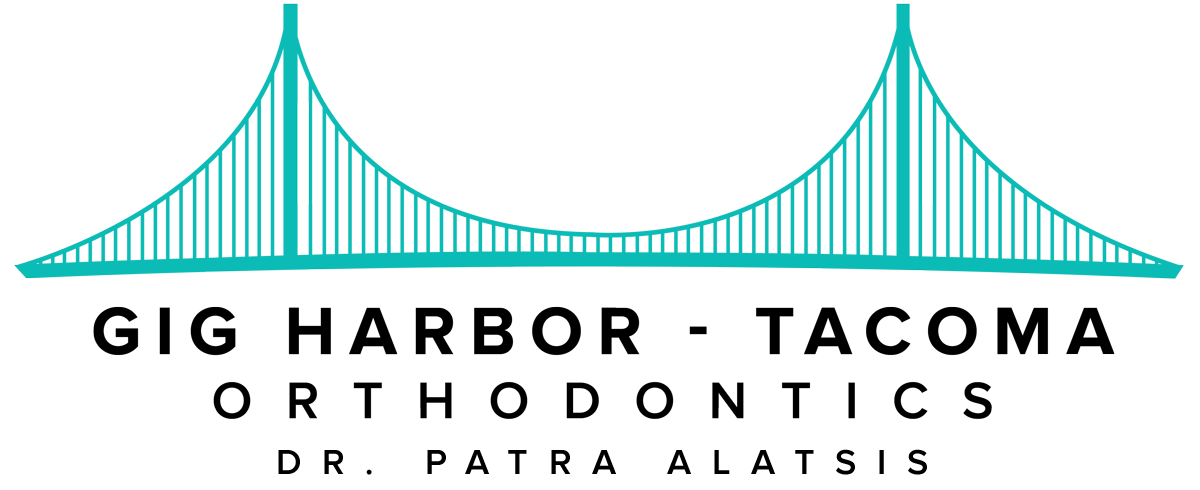 What Are Clear Braces? Benefits & Treatment Explained - Gig Harbor ...