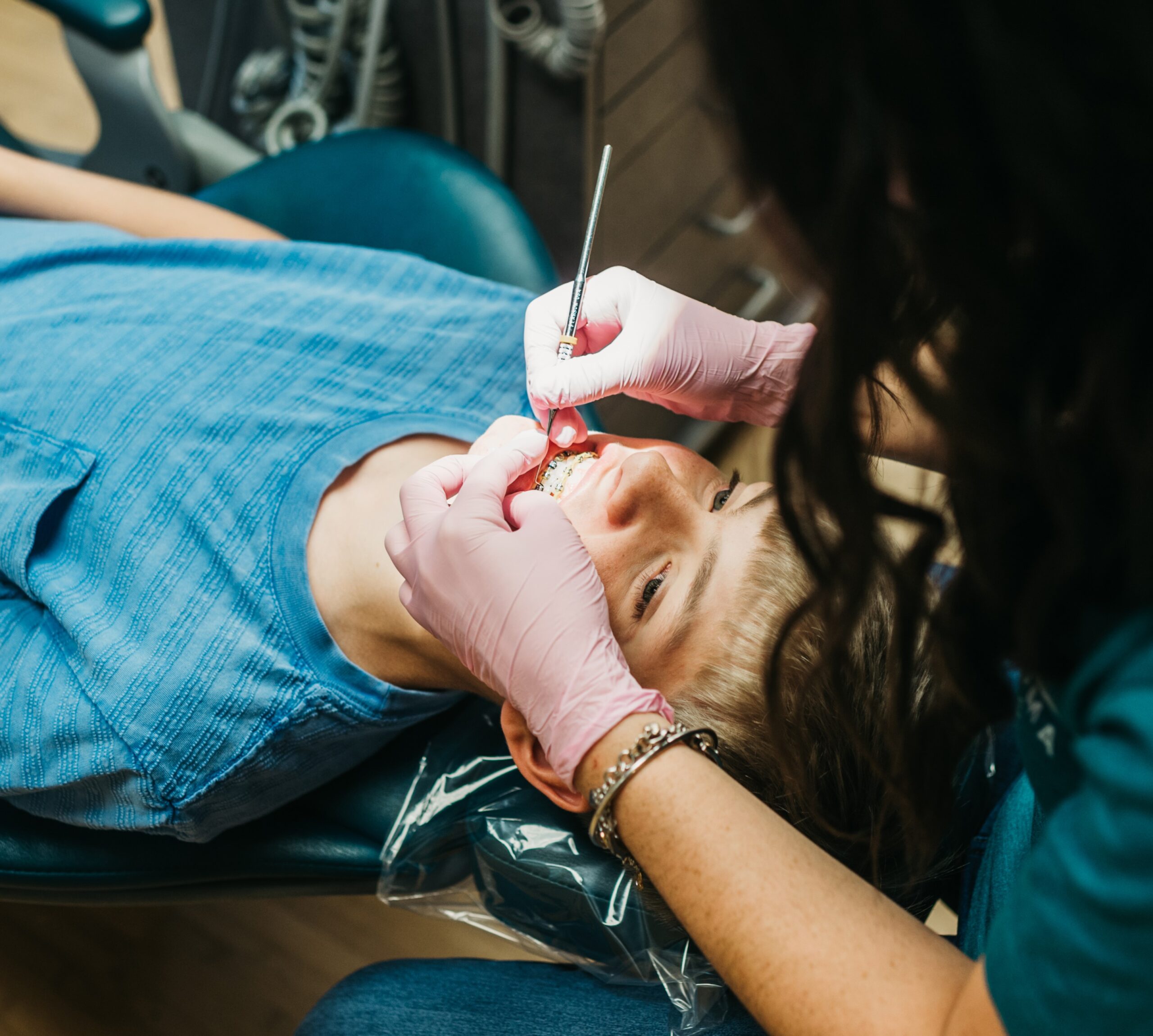 How to Clean Traditional Braces Properly: A Step-by-Step Guide - Gig ...